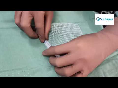 Hernia Mesh - Hernia Kit Latest Price, Manufacturers & Suppliers