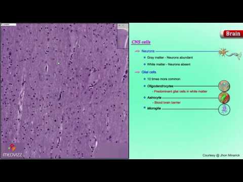 Histology of Brain tissue ( CNS ) :Shotgun Histology