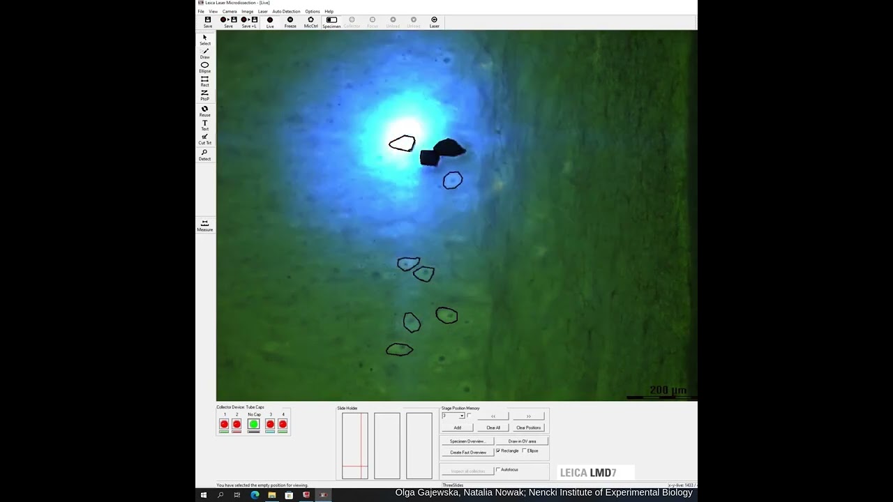 What is laser microdissection?
