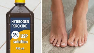 Hydrogen Peroxide on Your FEET - The Results Will SHOCK You