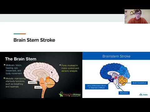 Stroke Education And The Different Types Of Stroke.