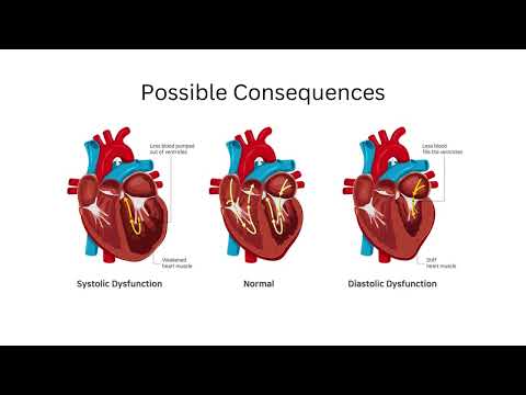 EECG-3D-Visualization ¦ Informatik ¦ Bachelorthesis von Ingold Elias