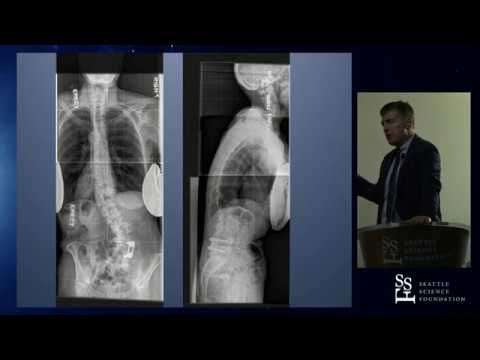 A Multidisciplinary Approach to the Management of Spinal Disorders - Sigurd Berven, M.D.