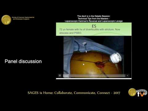 Laparoscopic Hartman's reversal & laparoscopic lavage: Panel discussion