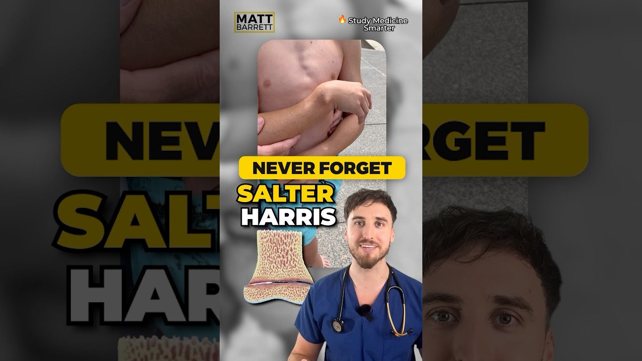 Easily remember the Salter Harris classification