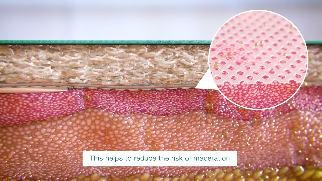 Silicone Wound Contact Layer Klinion