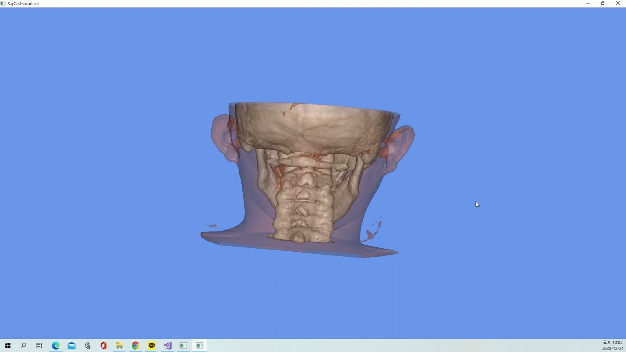 VTK Example - FixedPointVolumeRayCastMapperCT  - Cxx