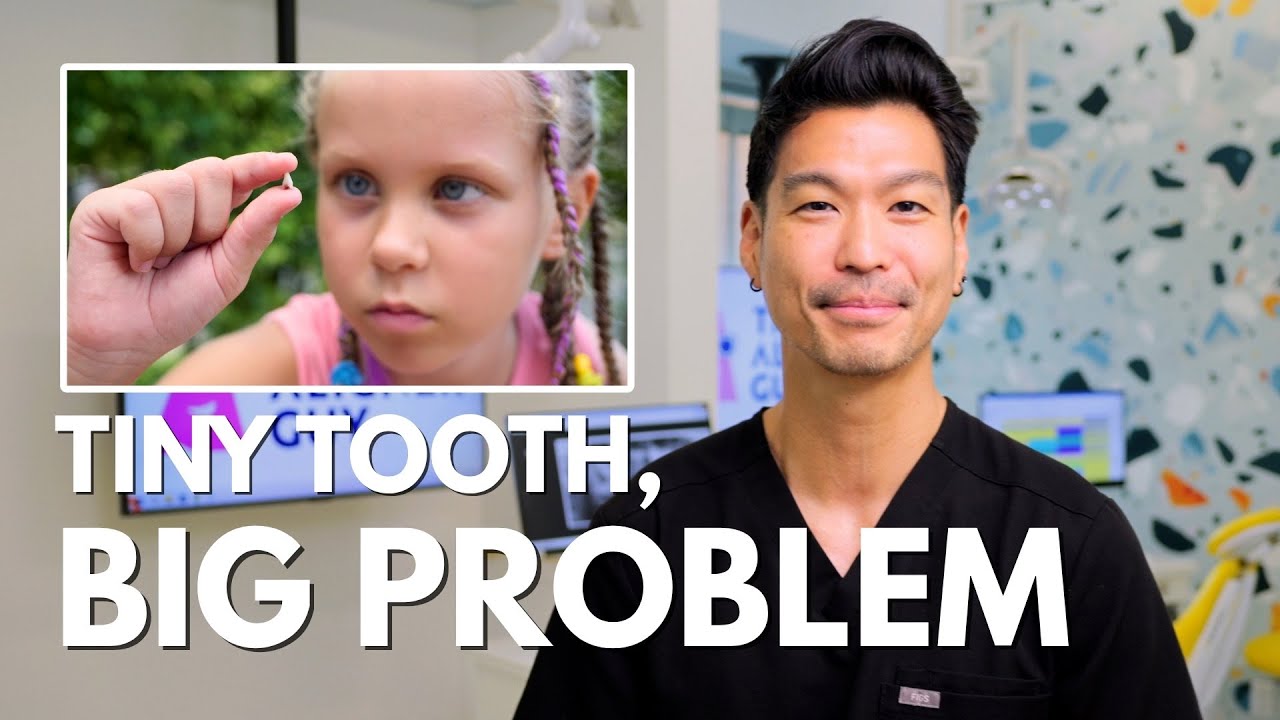 Early Baby Tooth Loss Explained (What Every Parent Should Know)