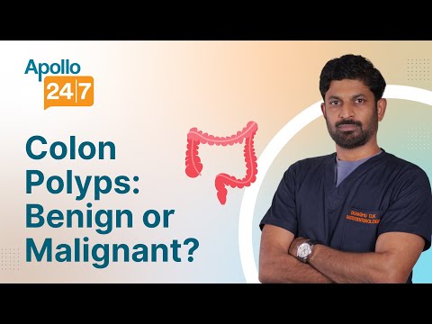 Are Colon Polyps Cancerous? | Dr. Raghu D K