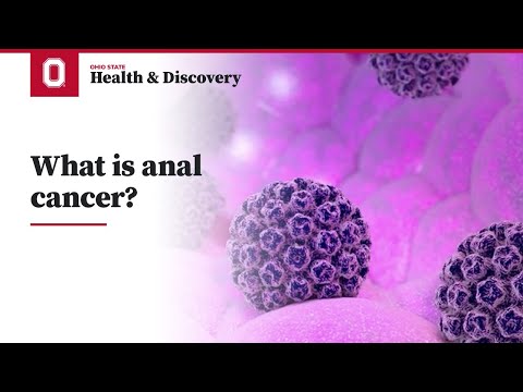 What is anal cancer? | Ohio State Medical Center