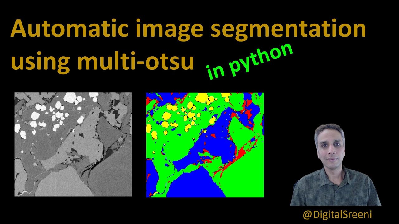115 - Auto segmentation using multi-otsu