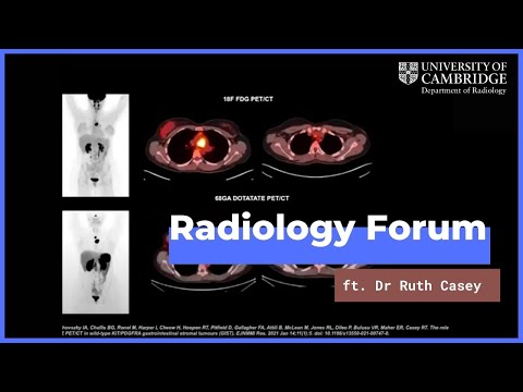 'Molecular Imaging in Inherited and Sporadic Endocrine Cancers' by Dr Ruth Casey