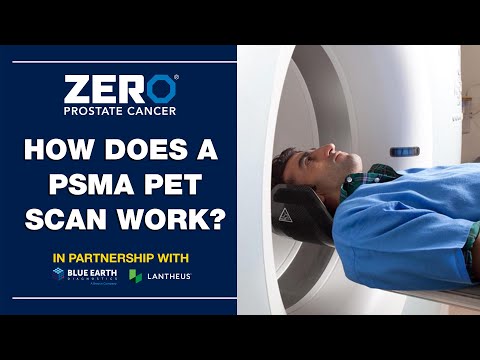 How Does a PSMA PET Scan Work?