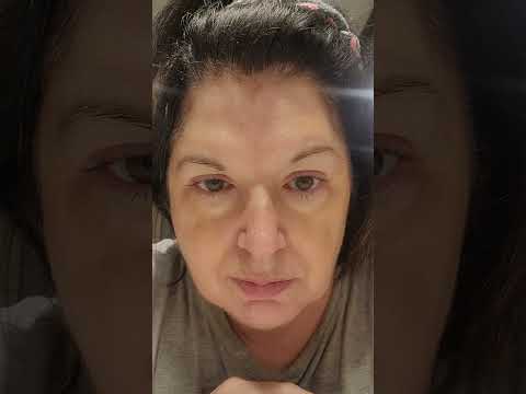 Dr. Melaxin EYEPHALT 1st time using it. Do you see a difference?