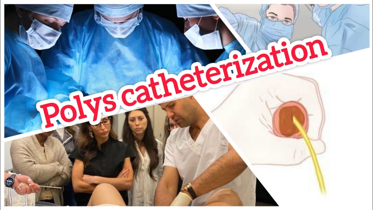 Mastering Polys Catheterization A Step by Step Video Tutorial