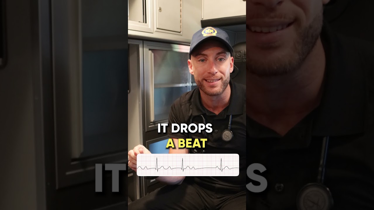 Helping A Student With A TOUGH EKG