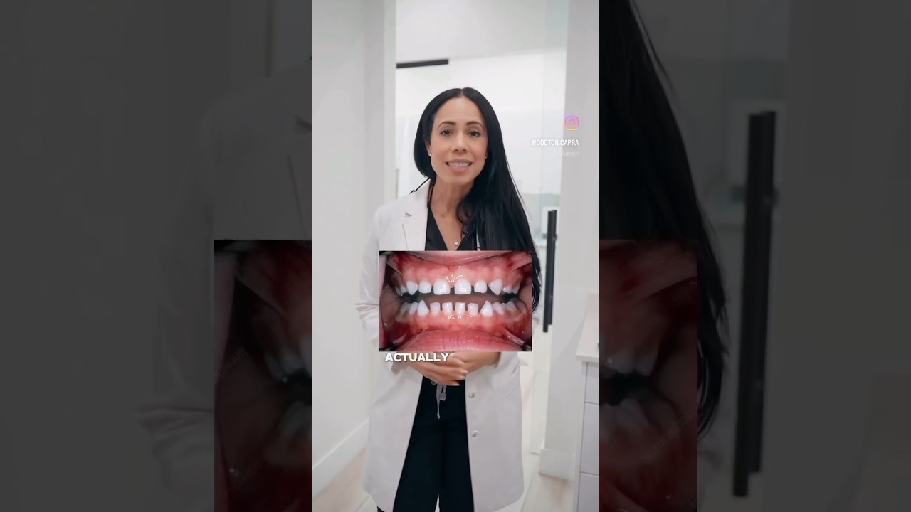 Are Gaps in Baby Teeth Bad? #dentist