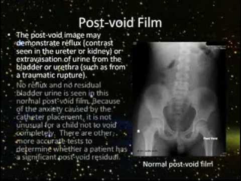 Cystography & Urethrography -- Part 1