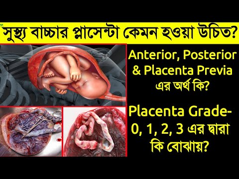 How is the placenta of the fetus? || What is called Anterior, Posterior, Low lying and Placenta Previa?