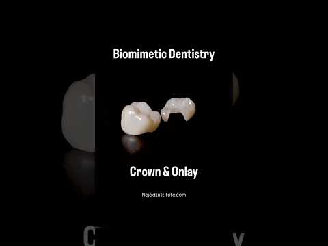 Biomimetic Dentistry. A crown and an onlay #biomimeticdentistry #dentist #digitaldentistry