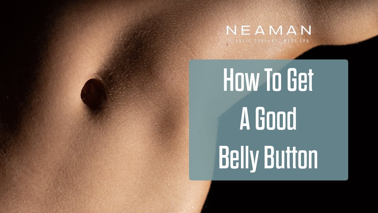 How To Get A GREAT Belly Button After Tummy Tuck?!