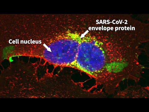 Research Spotlight: Sanders Lab | Center for Structural Biology ...