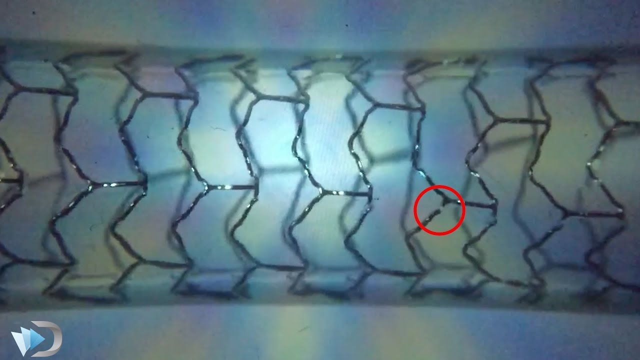 Fatigue to Fracture(FTF)