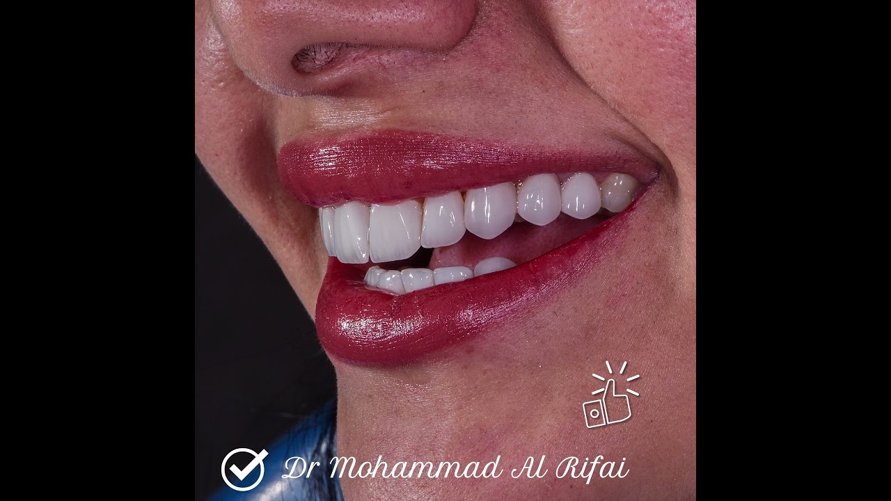 Dr. Mohammad Al Rifai – Al Ain, UAE