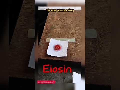 Tissue processing #tissue #hospital #histology #pathology#short#doctor #song#medical #clinical#lab