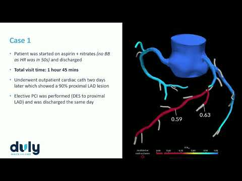 Sponsored Symposium | Cardiac CT in an office/outpatient setting – How to make it successful