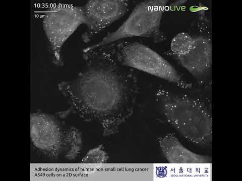 Adhesion dynamics of human non‐small cell lung cancer A549 cells on a 2D surface