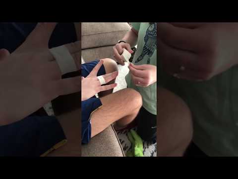 Buddy Taping (fingers) - Coaching Authorization
