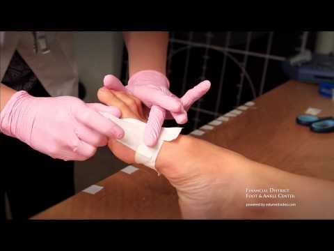 Turf Toe Taping for Hallux (Big Toe) Injuries | Dr. Jenny Sanders Shoe Blog