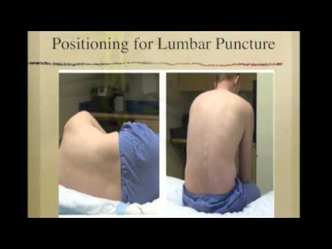 Lumbar Puncture