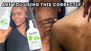 How to properly use the AMLACTIN BODY LOTION | Tips on how to get better results #Amlactinbodylotion