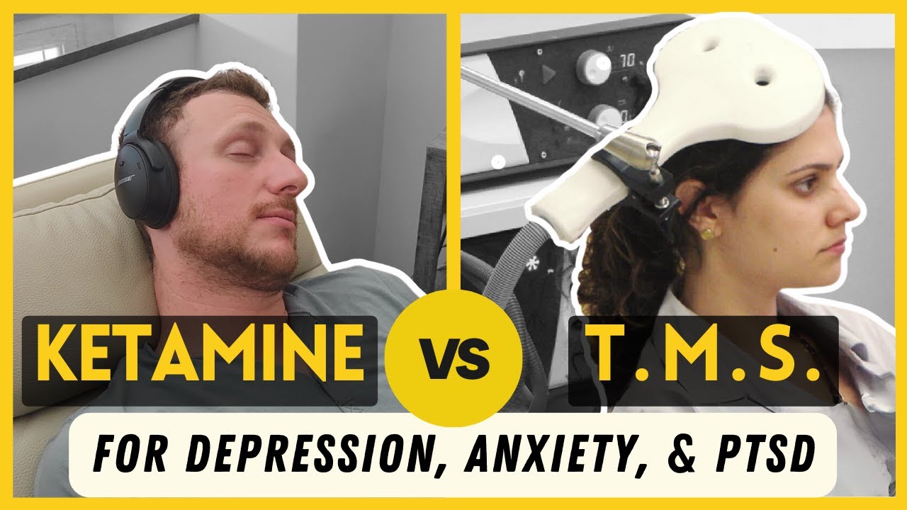 TMS vs. Ketamine: Which One Is Better?