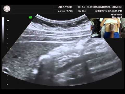 Abdominal ultrasound landmarks.