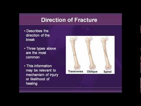 Radiology of Extremity Fractures (2003)