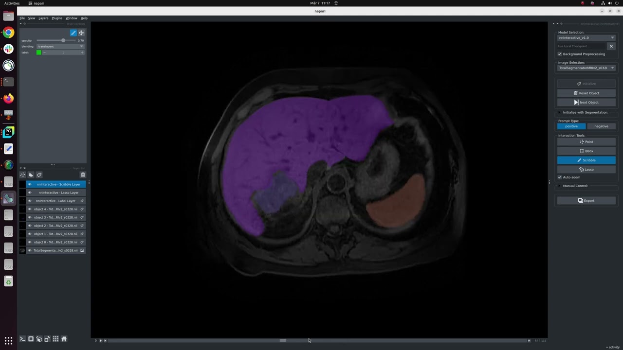 [Napari] MRI organ segmentation with nnInteractive