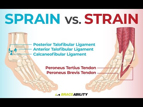 Sprain VS Strain