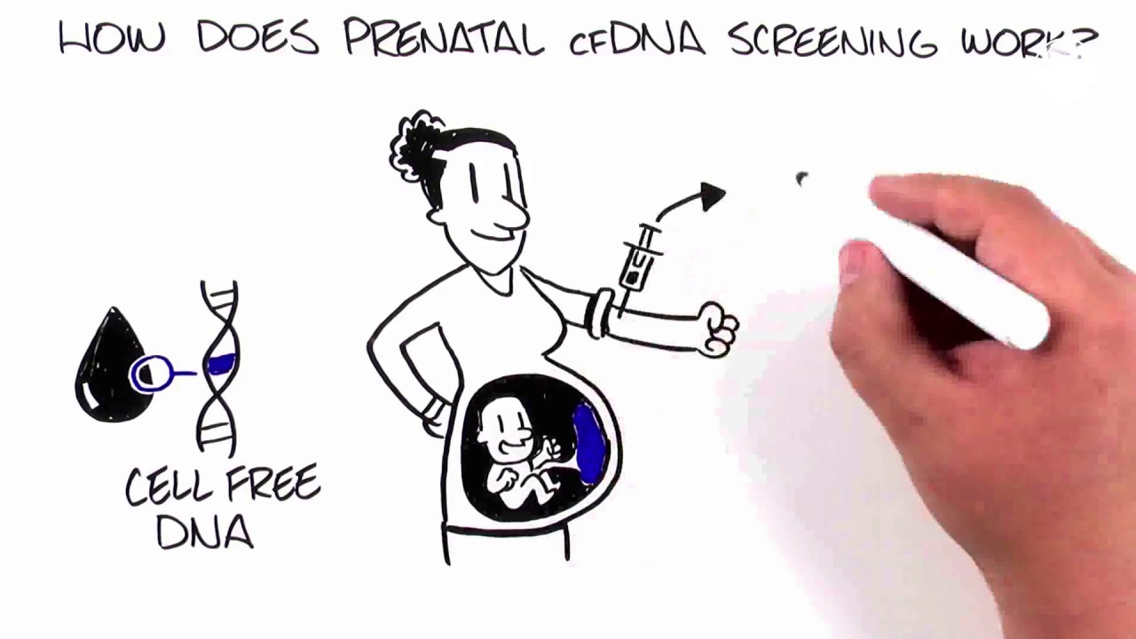 Prenatal Screening Options: cfDNA (cell free DNA)