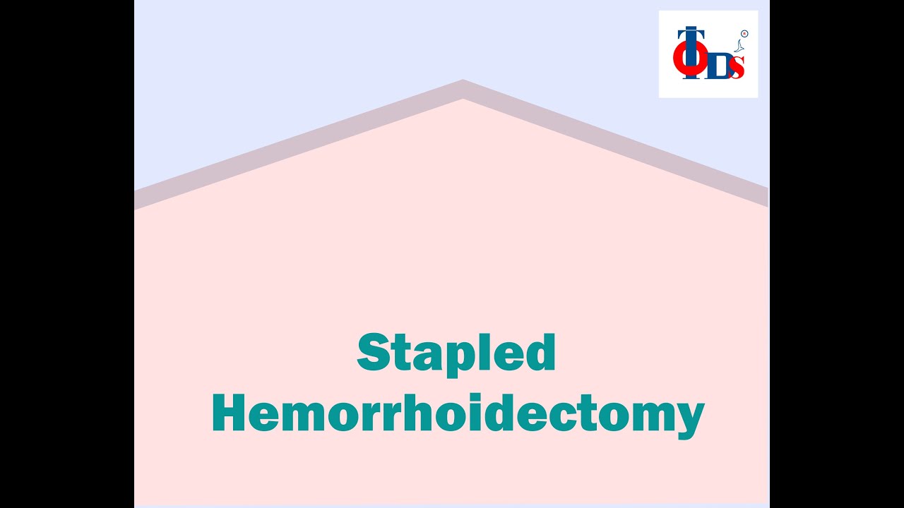 Stapled Haemorrhoidectomy  | Dr. Tulip JP Nagar