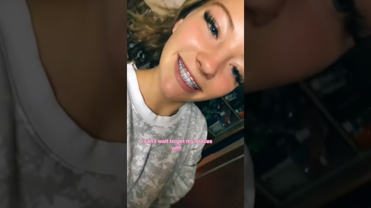 She Had FAKE Braces For A YEAR!? 🤯🦷
