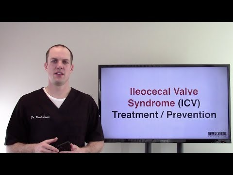 Ileocecal Valve Syndrome Prevention and Treatment