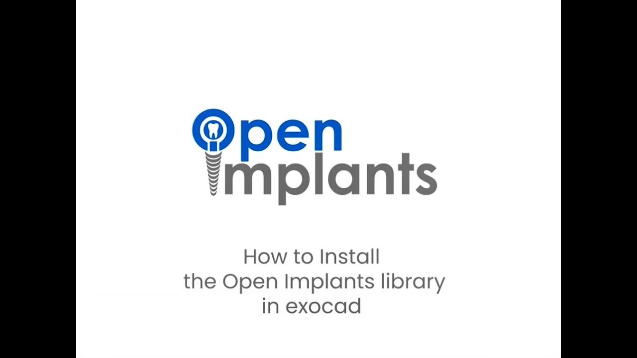 Open Implants exocad library install
