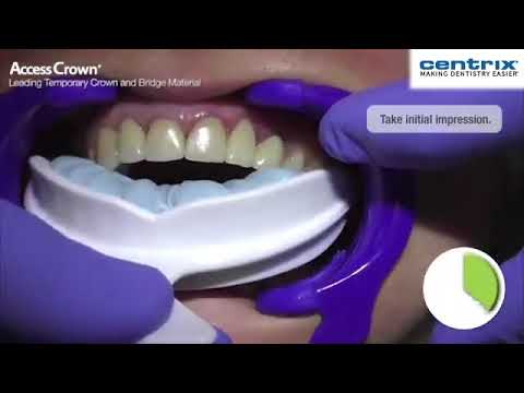 Access Crown Centrix для изготовления временных коронок и мостов, 76г (1:1) - Стоматологический ...