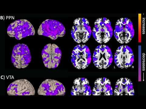 VISE Affiliated Lab: Brain Imaging and Electrophysiology Network (BIEN) Lab