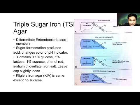 Triple Sugar Iron (TSI) Agar | Legend Review Center