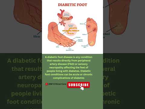 Diabetic Foot|Ulcer in Foots |Foot Ulcers due to Diabetes|Gangrene Foot #diabeticfoot #ulcersinfoot