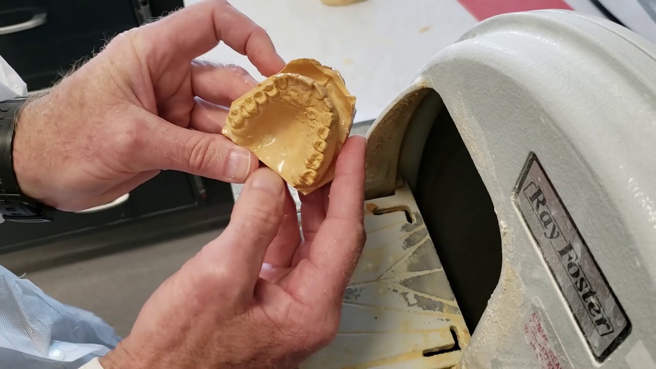 Trimming the Final Casts - Dr. Mark R. Taylor